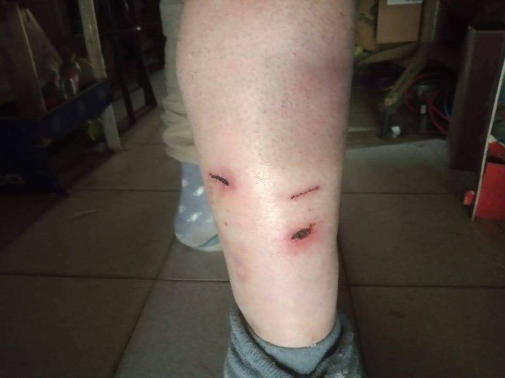 Vecino mordido por un perro | Chacabuco en Red